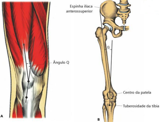 Síndrome da Dor Femoropatelar