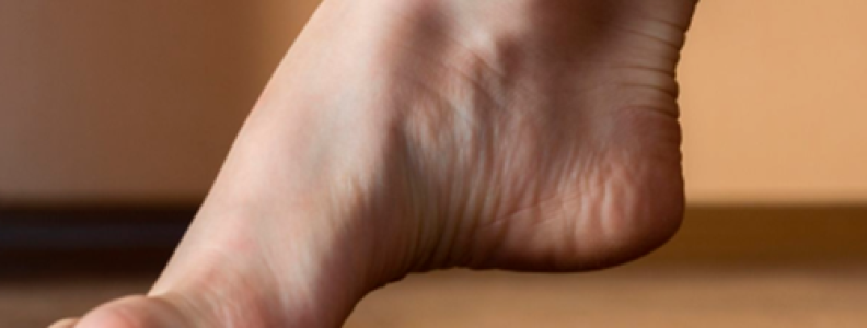 Pé cavo: descubra todas as características desse tipo de pé!