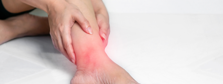 Tornozelo inchado e dor ao pisar: o que pode ser e soluções