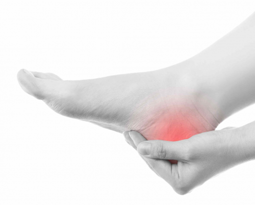 O calcanhar de Aquiles: da história à vida real | Pés Sem Dor